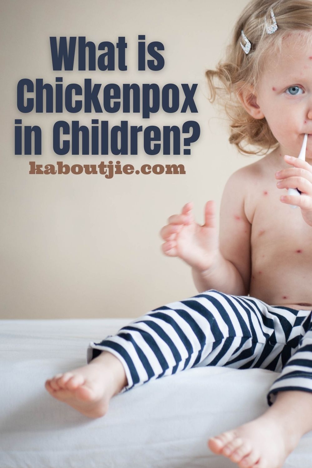 What is Chickenpox in Children?
